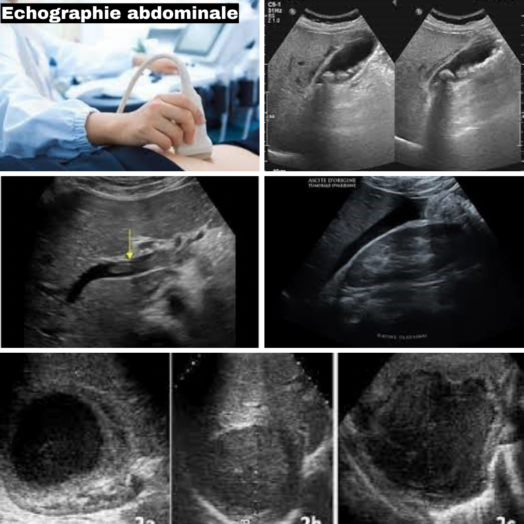 Imagerie Médicale - Dr Lahbabi Mounia