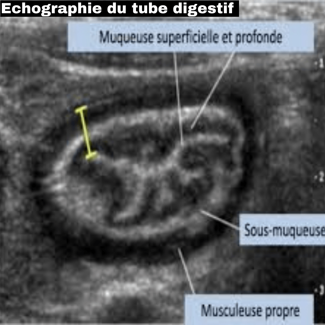 Imagerie Médicale - Dr Lahbabi Mounia