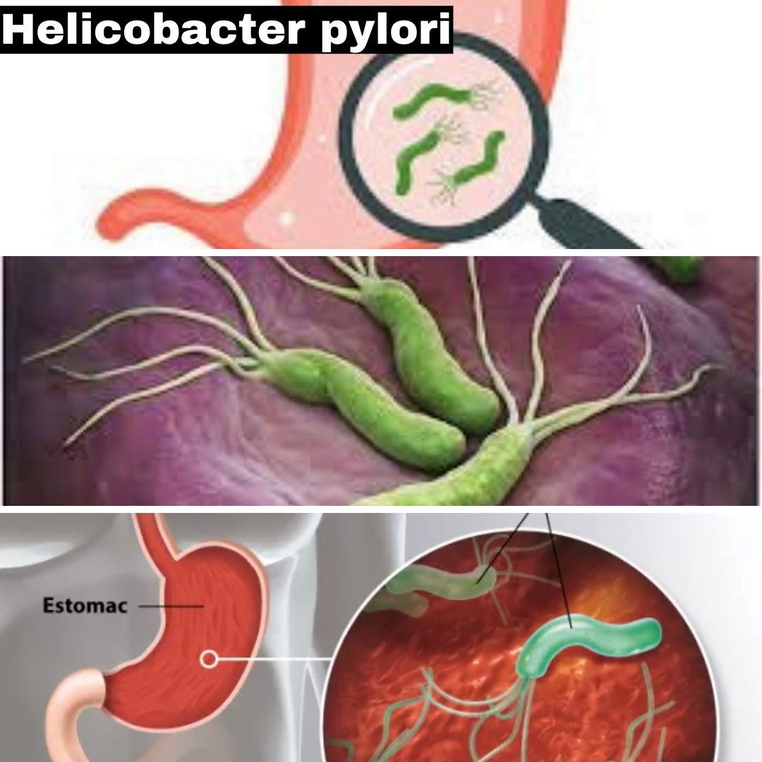 Helicobacter Pylori - Dr Lahbabi Mounia